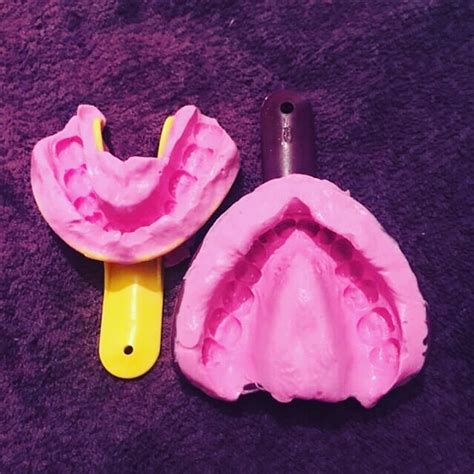 Jaw Impression Kit Braces For Fun