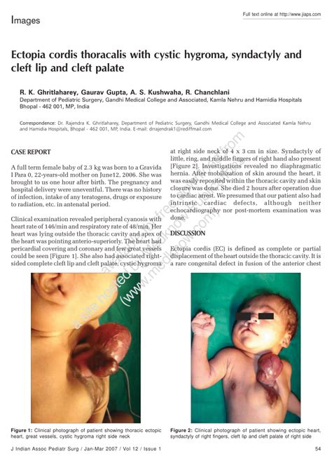 Pdf Ectopia Cordis Thoracalis With Cystic Hygroma Syndactyly And
