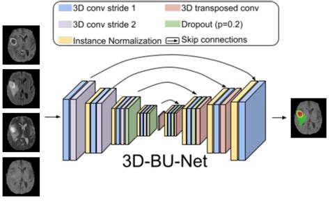 Network Architecture Diagram Of The Modified 3d Bu Net Nair Et Al Download Scientific