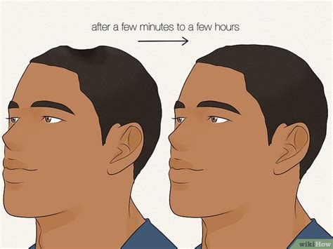 Headphone Dents Why They Happen How To Fix Them