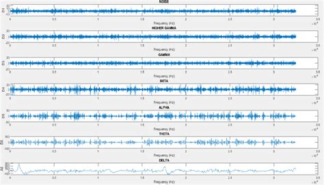 Decomposition Of Eeg Signal In Various Frequency Bands Using Db6 With 6 Decomposition Of Eeg Signal In Various Frequency Bands Using Db6 With 6