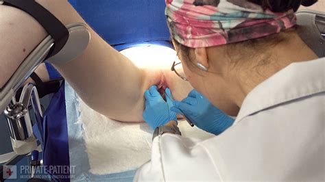 Monitoring Private Patient Com