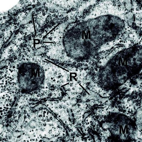 Transmission Electron Micrograph Showing A Portion Of Cytoplasmic Download Scientific Diagram