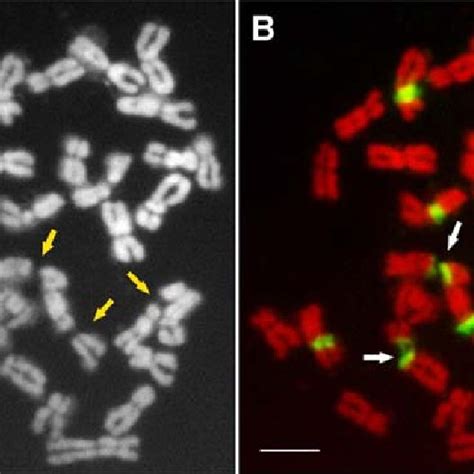 Fluorescence In Situ Hybridization With 45s Rdna As The Probe Shows