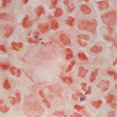 Rhodococcus Archives Eclinpath