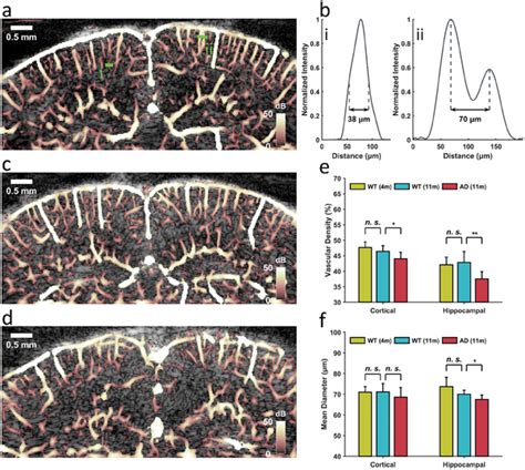 Cerebral vasculature imaging of living mouse brains through HVμDI a Download Scientific