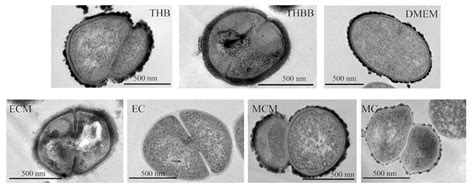 Streptococcus Pneumoniae Electron Micrograph 240 Streptococcus