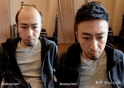 每天戴假发会很痛苦吗？（跟每天化妆一样） 知乎
