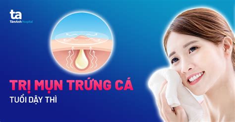 Rất Hay 10 Cách Trị Mụn Trứng Cá ở Tuổi Dậy Thì An Toàn Và Hiệu Quả