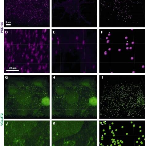 Pre And Post Synaptic Localizations To The Motor Neuron Ad Show