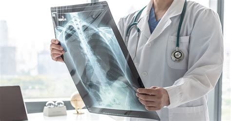 Stopping Lung Cancer Before It Progresses 3 Million Research