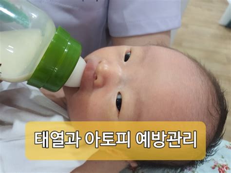 신생아 태열과 아토피 예방법추천 아기세제와 기저귀 네이버 블로그