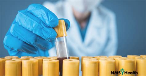 What Is A Titer Test Titer Testing Your Employees Nms Health