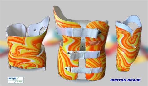 Scoliosis Bracing And Exercises Comprehensive Guide To Treatment And