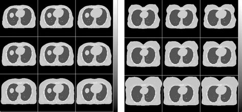 Sample Transaxial Images Of The Attenuation Distribution From Male A Download Scientific
