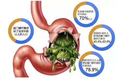 根除幽门螺杆菌，那些天然替代疗法真的有用吗？凤凰网