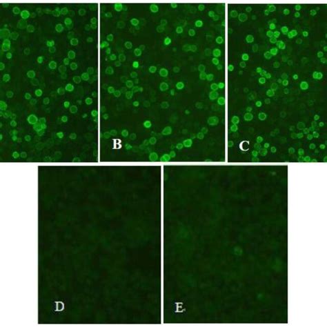 Detection Of The Recombinant Proteins Expression Using Indirect Download Scientific Diagram
