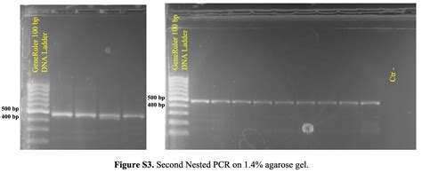 Integration Of Codon Optimized Modified Sars Cov 2 Spike Mrna Into