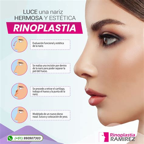 👃estiliza La Forma Y El TamaÑo De Tu Rinoplastia Ramirez