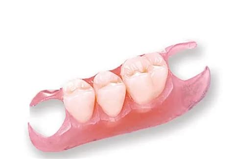 Nesbit Partial Denture Direct Dental Prosthetics