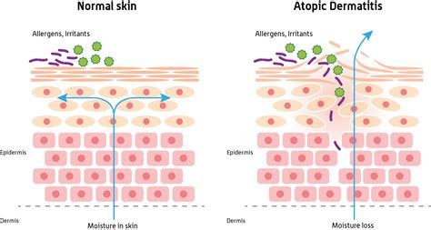 Skin Barrier Testing