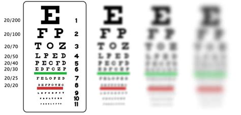 Are You A Myope Eyeplus Optometrist
