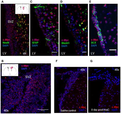 C Myc Is Expressed In The Svz Cell Lineages A B C Myc Staining In