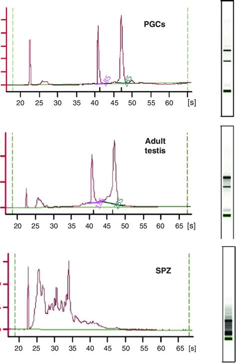 Electropherograms Of Total Rnas From Male Germ Cell And Tissue Assessed