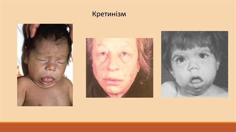 Презентація на тему Ендокринна регуляція функцій організму — презентації з біології Gdz4you