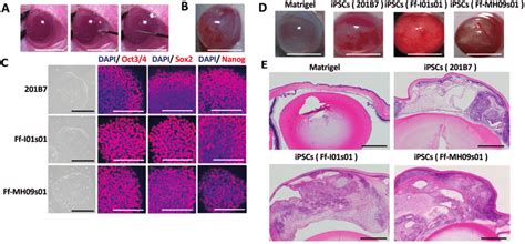 Teratoma Formation In The Anterior Chamber Of Nude Rats A