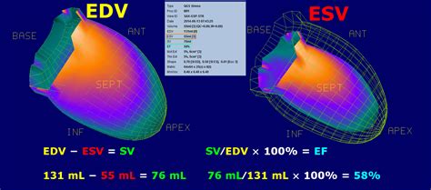 Heart Function Including Ejection Fraction Ef • Myheart
