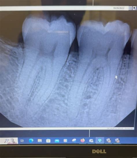 Drabdullah Al Ateeq Posted On Linkedin