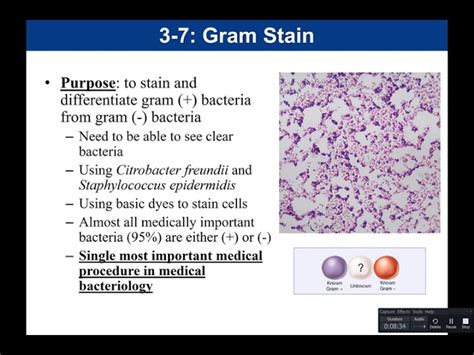 Staphylococcus Epidermidis Capsule Stain