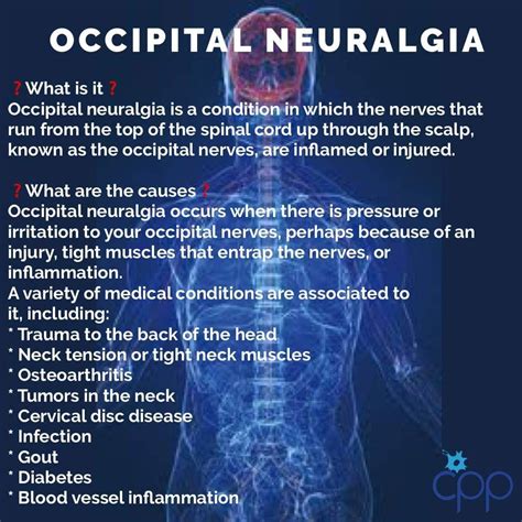 Cervicogenic Headache And Occipital Neuralgia Artofit