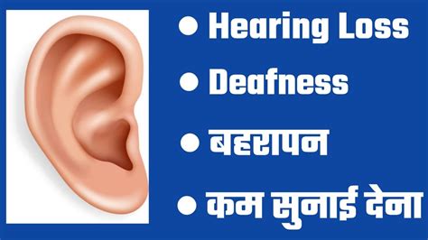 कम सुनाई देना । बहरापन । Hearing Loss । Deafness L Best Homeopathy
