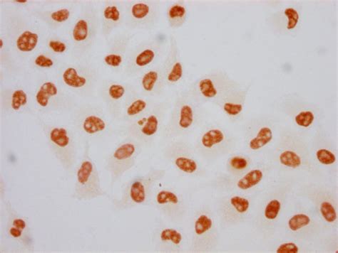 Phospho Rna Pol Ii Ctd Ser5 Recombinant Monoclonal Antibody 2h4