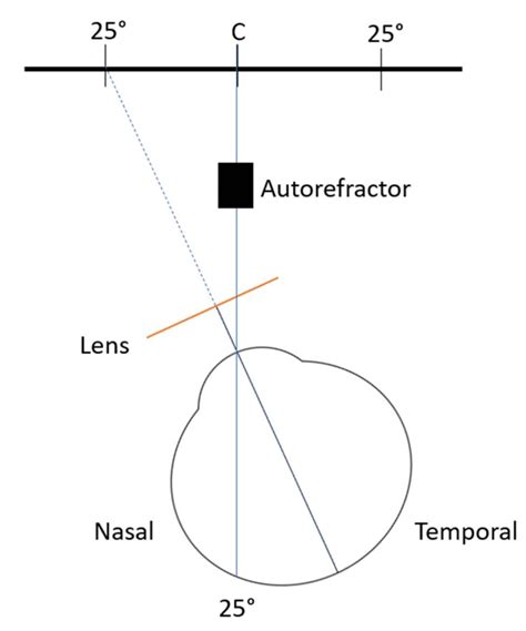 Schematic Illustration Of The Measurement Of The Peripheral Refraction Download Scientific