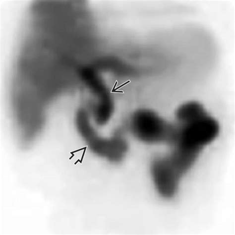 Imaging Approach To The Biliary System Radiology Key Imaging Approach To The Biliary System Radiology Key