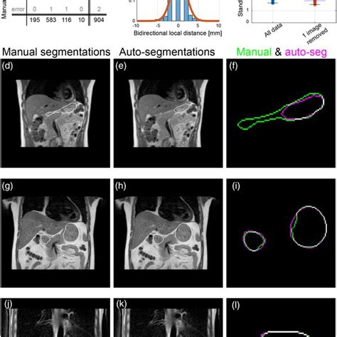Auto‐segmentation Validation A Confusion Matrix Listing The Number Download Scientific