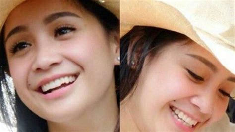 Detail Macam Macam Lesung Pipi Koleksi Nomer 7