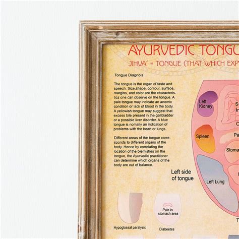 Ayurveda Tongue Diagnosis Poster Ayurveda Tongue Chart Etsy
