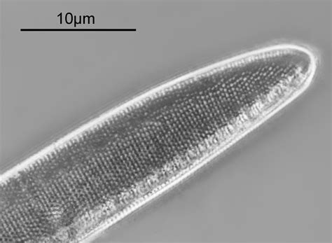 Epulopiscium Fishelsoni