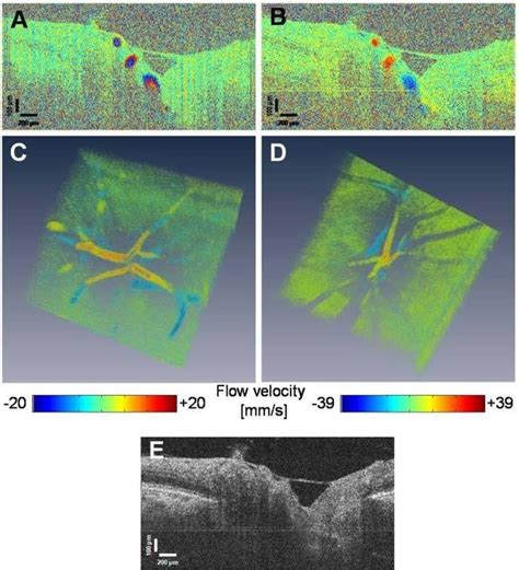 Volumetric Doppler Oct Imaging Of Retinal Vasculature A Doppler Oct Download Scientific