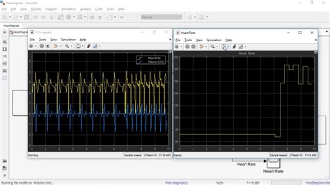 How To Build A Heart Rate Detector Using Arduino And Matlab Video Matlab Simulink