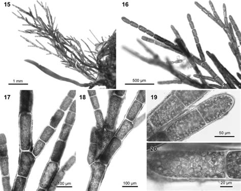 Cladophora Microscope Labeled