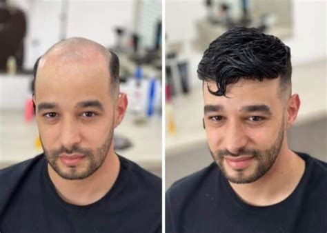 20 Trendiest Toupee Hairstyles For Men To Try In 2026