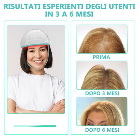 Kts Wireless Hair Growth Cap 109pcs Laser Diodes Lllt Laser Therapy Device For Scalp 3800mah