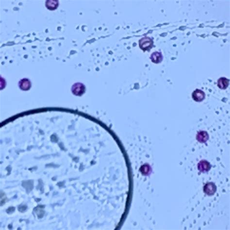 Improve Circle Detection For A Spicific Color In Python Opencv Stack