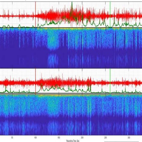 Modeler Rfm Score Chart For Model 1 Download Scientific Diagram