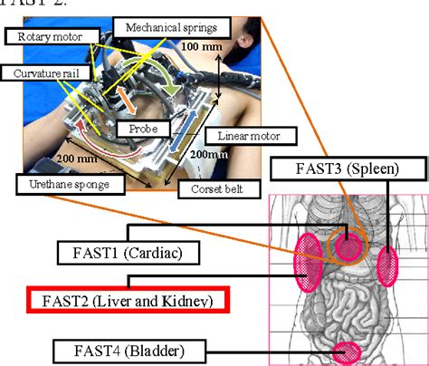 table i from internal bleeding detection algorithm based on